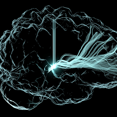 BRAIN Initiative Contest Garners Eye-Catching Photos, Videos | NIH Record