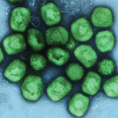 Keeping An Eye on Monkeypox | NIH Record