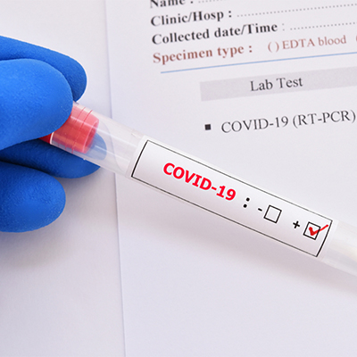 OMS Resumes Normal Covid Reporting Procedures | NIH Record