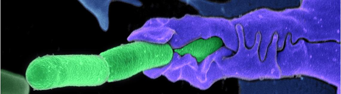 March 24, 2017 | NIH Record